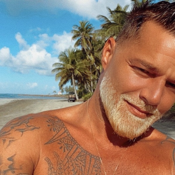 El antes y después de Ricky Martin: ¿Qué le pasó a su rostro?