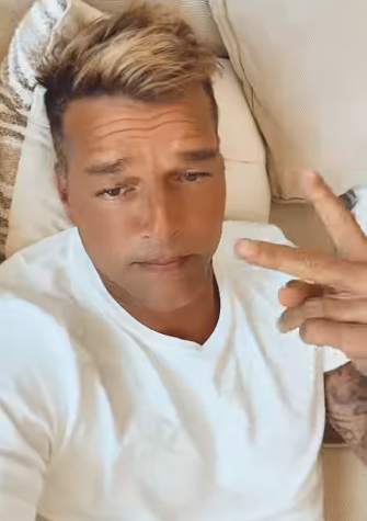 El antes y después de Ricky Martin: ¿Qué le pasó a su rostro?