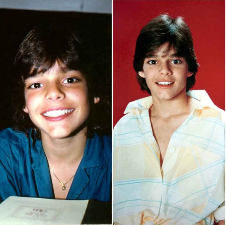 El antes y después de Ricky Martin: ¿Qué le pasó a su rostro?