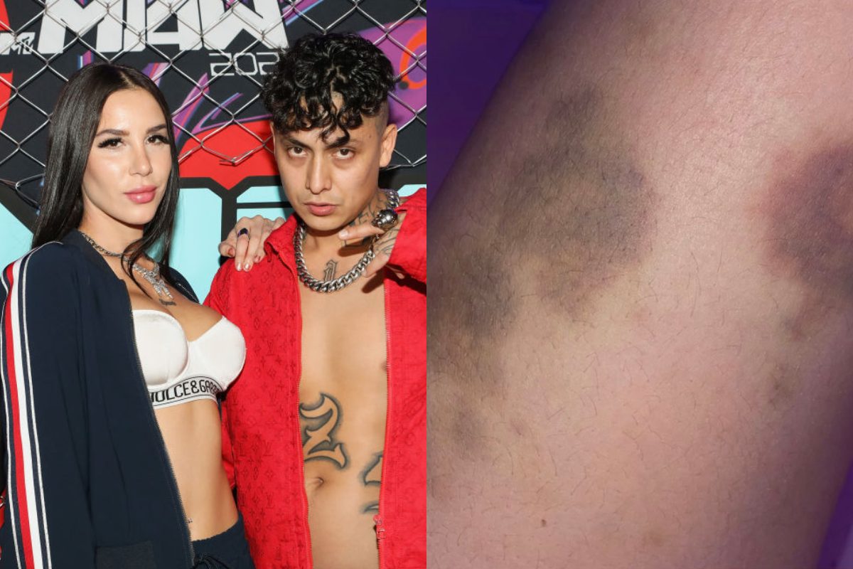 Alemán rompe el silencio tras presunta violencia a Akasha, su novia (FOTO)